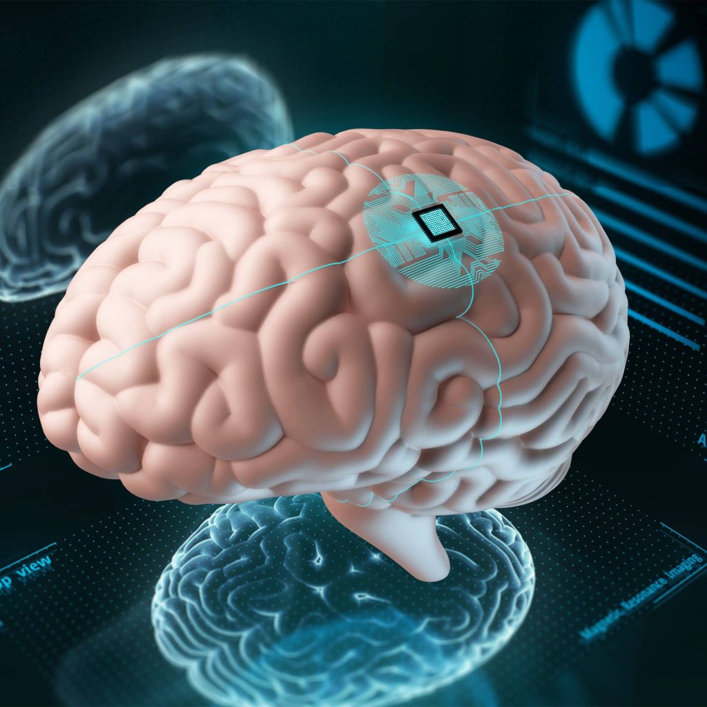 ¿Qué es Neuralink? El chip neuronal que empezará a probarse en humanos ...